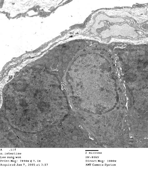 [펌] Tem 사진 올려요 네이버 블로그