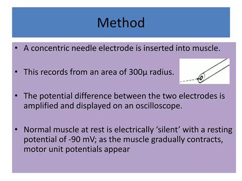 EEG INTERPRETATION PPTX