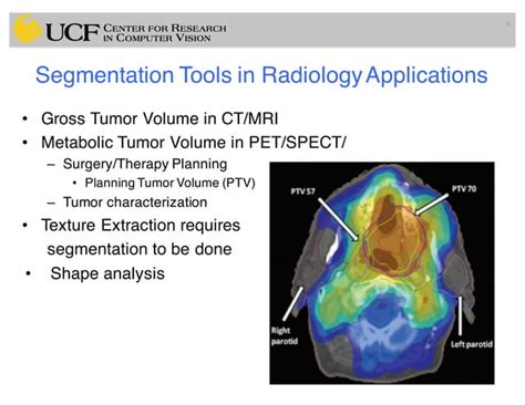 Lec Medical Image Segmentation I Radiology Applications Of Segmentation And Thresholding