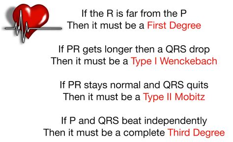 Av Heart Block Poem First Second Third Degree Types Ecg Rhythm