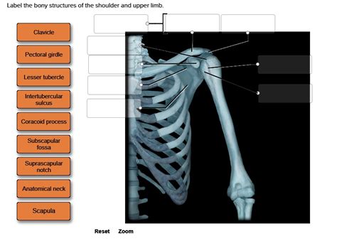 Label The Bony Structures Of The Shoulder And Upper Limb Label The Bony Structures Of The