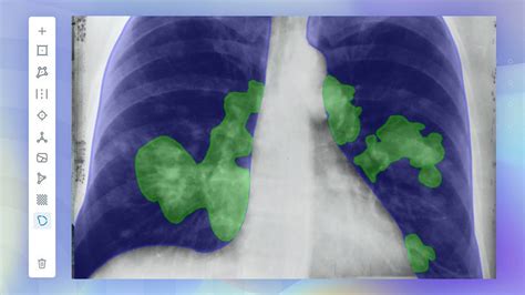 Artificial Intelligence Advancements In Healthcare Keylabs