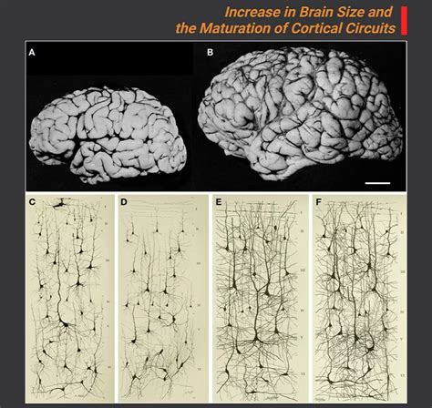 The Neurotypical Brain Versus The Autistic Brain