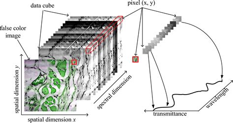 Review Of Spectral Imaging Technology In Biomedical Engineering Achievements And Challenges