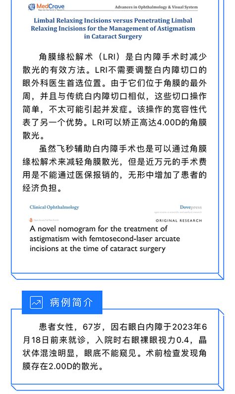 没有办法的办法 角膜缘松解术为多焦点人工晶状体开道 上海展鑫优视医疗器械有限公司