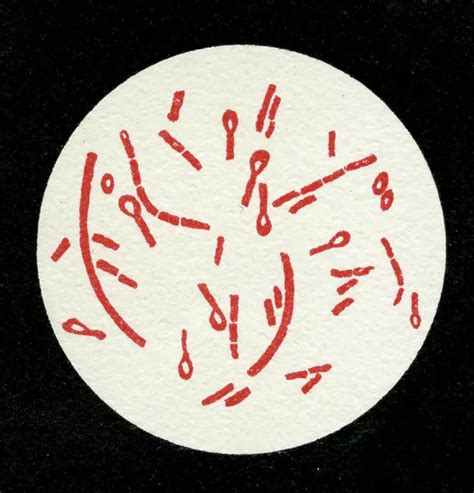 Clostridium Tetani Clostridium Tetani Wm Microscope