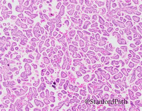 Choroid Plexus Histology