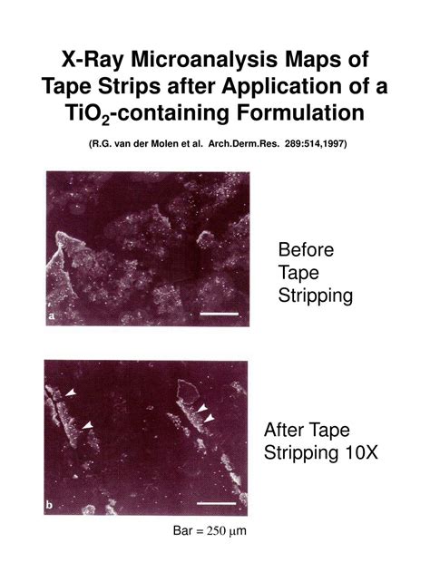 Ppt Before Tape Stripping Powerpoint Presentation Free Download Id 3285659