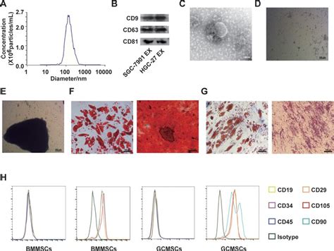 Identification Of Exosomes In Gastric Cancer Gc Cells And Primary