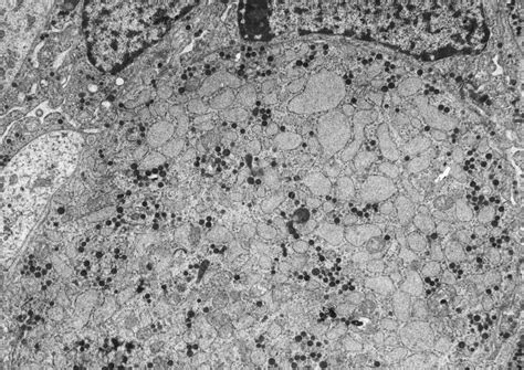 Pituitary Gland Gonadotroph Cell Stock Image Image Of Electron