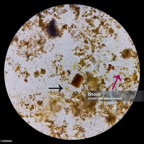 Giardia Lamblia Cysts And Trophozoite Form Muscle Fiber In Stool