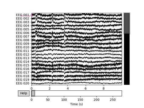 Transform Eeg Data Using Current Source Density Csd — Mne 0221
