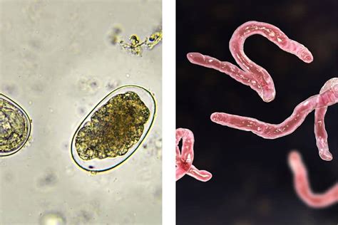 Can You See Hookworms In Cat Poop At Alice Fisher Blog