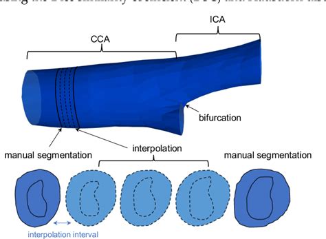 Figure 2 From Development Of A Three Dimensional Carotid Ultrasound Image Segmentation Workflow