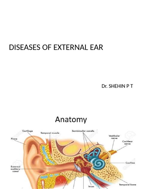 Diseases Of Ext Ear 29 1 25 Pdf