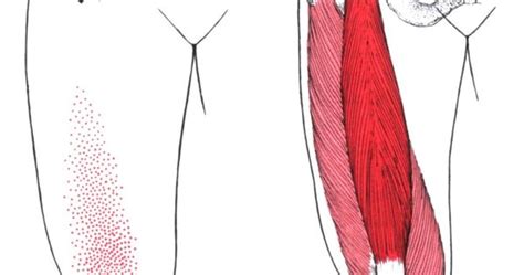 Rectus Femoris The Trigger Point Referred Pain Guide Vrogue Co
