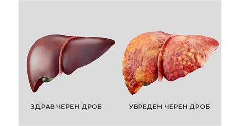 Омазнен черен дроб как да го пречистим с билки 24 Здраве
