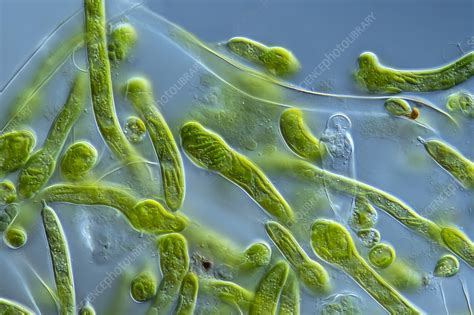 Ophiocytium Algae Light Micrograph Stock Image C057 7944 Science Photo Library