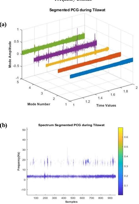 Figure From Classification Of Phonocardiography Based Heart Auscultations While Listening To