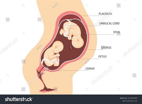 Double Pregnancy Anatomy Uterus Twin Fetuses Stock Vector Royalty Free 2223587695 Shutterstock