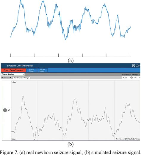 Figure 7 From An Eeg Generator Capable Of Reconstructing Signals From Any Edf File And