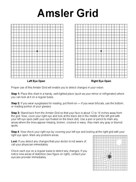 Amsler Grid Pdf