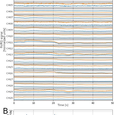 Steps Of The Rco Algorithm Portion Of Bvp Signal Affected By Motion Download Scientific