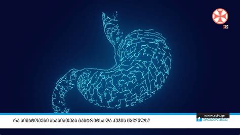 რა სიმპტომები ახასიათებს გასტრიტსა და კუჭის წყლულს Youtube
