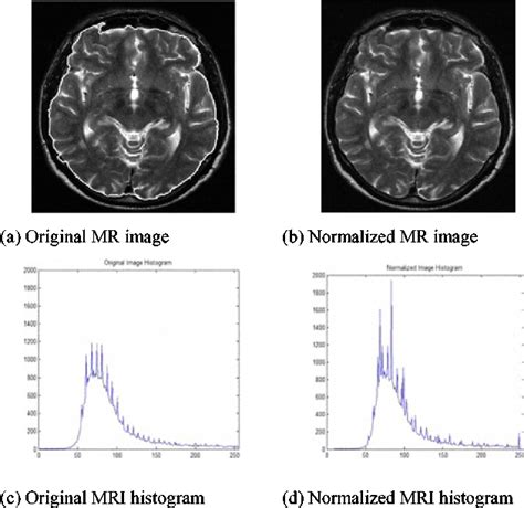 Figure I From Brain Mr Image Normalization In Texture Analysis Of Multiple Sclerosis Semantic