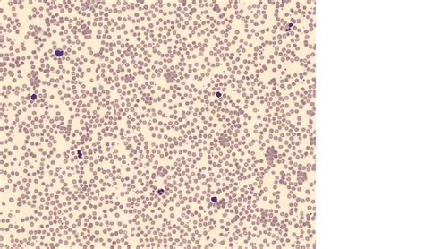 Rbc Agglutination Test Ppt Blood Grouping Slide And Tube Methods