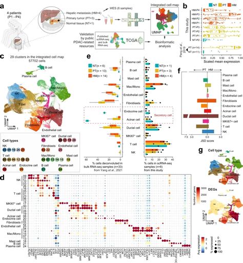 单细胞转录组分析提示pancreatic Cancer肝转移中的免疫抑制tumor微环境 上海慕柏生物医学科技有限公司