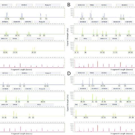 Str Profiles From Several Forensic Sample Types Generated Profiles Are