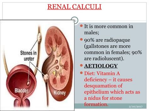 Diseases Of Excretory System Ppt
