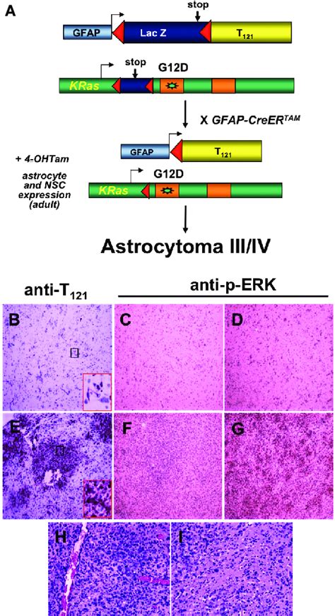 Conditional Inactivation Of Prb P107 And P130 Combined With Ras