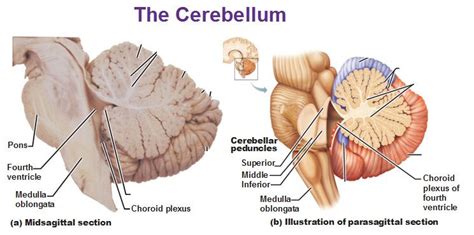 The Cerebellum Midsagittal Section And Parasagittal Section