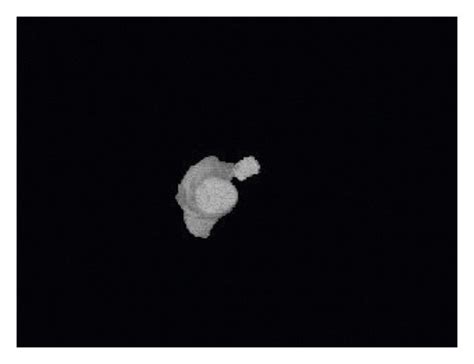 Experiments With The Pedestrian In Different States A Original Image Download Scientific