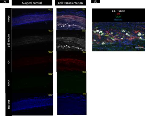 Properties Of Cells In The Transplantation Site A Longitudinal Download Scientific Diagram