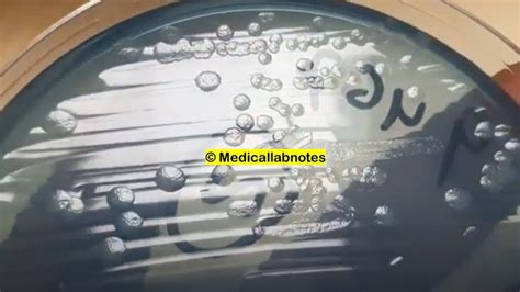 Morganella Introduction Archives Medical Notes