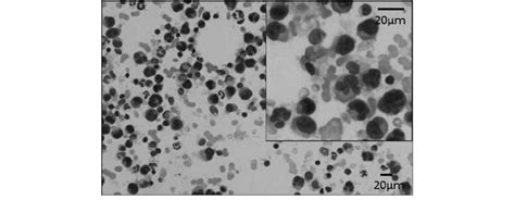 Cytological Examination Of Needle Aspirates From Bone Marrows Needle Download Scientific