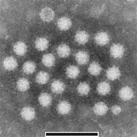 Astroviruses Clinical Tree