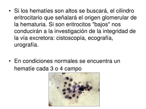 PPT Examen De Orina PowerPoint Presentation ID