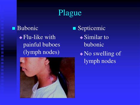 Ppt Agents Of Bioterrorism Powerpoint Presentation Free Download