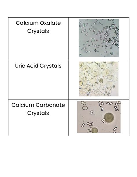 Crystals Medical Laboratory Science Calcium Oxalate Crystals Uric