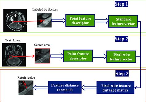 Flow Chart Of Anatomical Pois Detection In A Head Mri Scan Anatomical