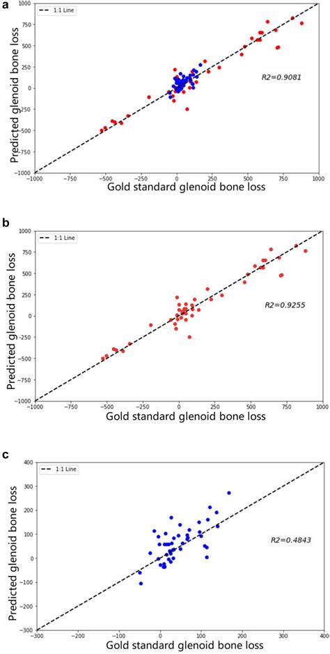 Glenoid Segmentation From Computed Tomography Scans Based On A 2 Stage