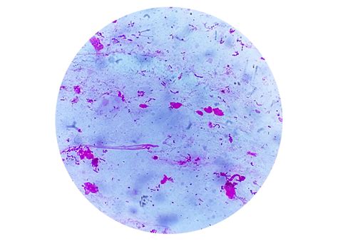 Premium Photo Gram Stain Gram Positive Cocci Or Gram Positive