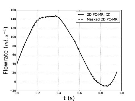 16 Inlet Flow Waveform Prescribed As Inlet Boundary Condition Of The Download Scientific