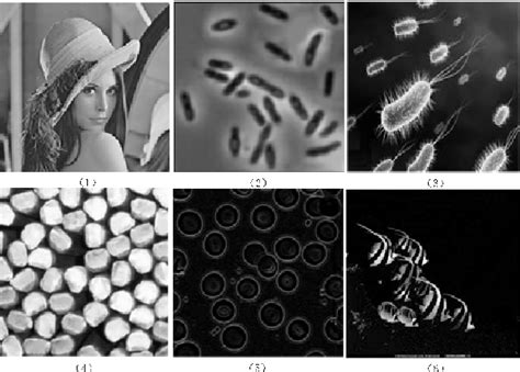 Figure 1 From Image Segmentation With Pcnn Model And Immune Algorithm Semantic Scholar