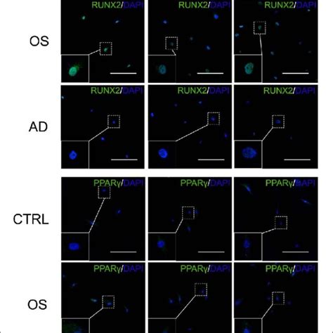 The Expression Of Osteogenic Specific Markers Runx2 Osterix And Download Scientific