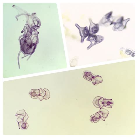 Echinodermata Larvae Slides Diagram Quizlet